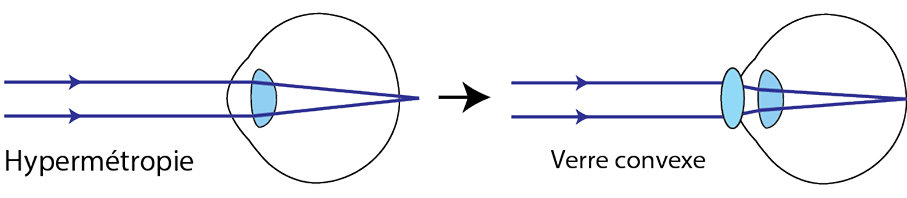 Consultations - Centre d'Ophtalmologie Galand